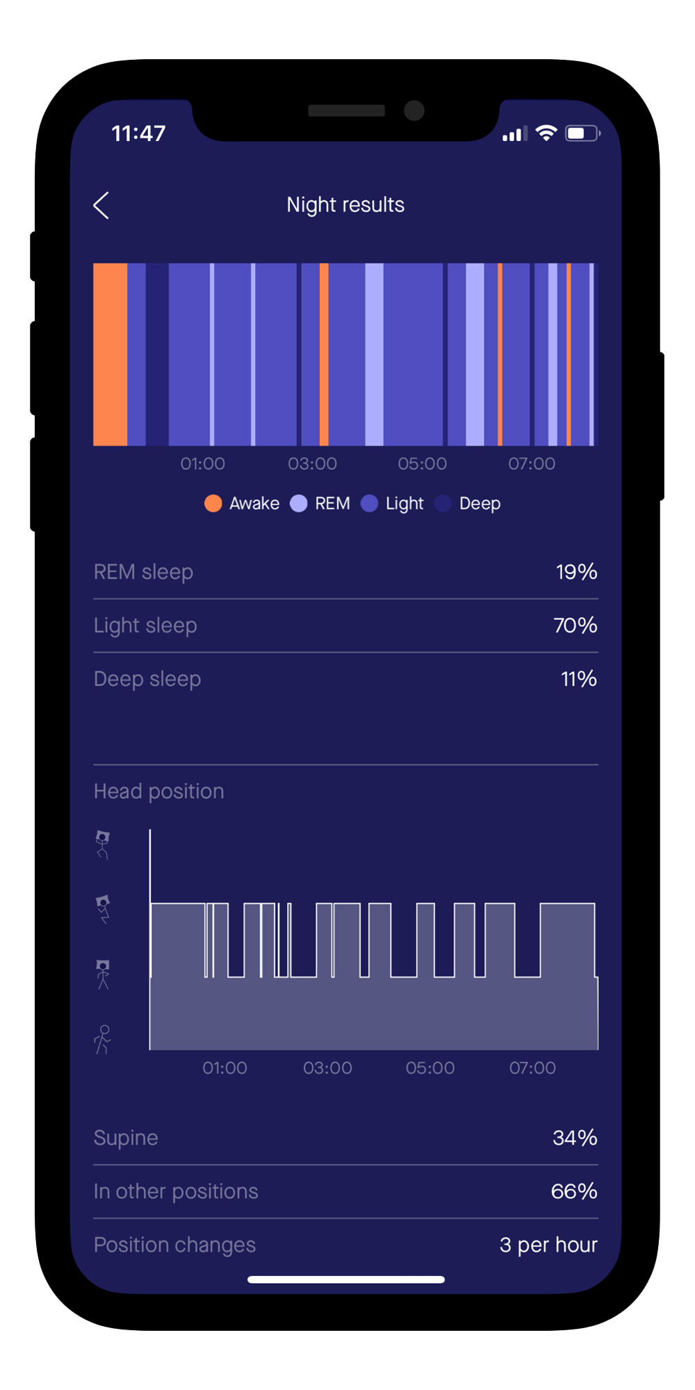 Sleep Test Reporting